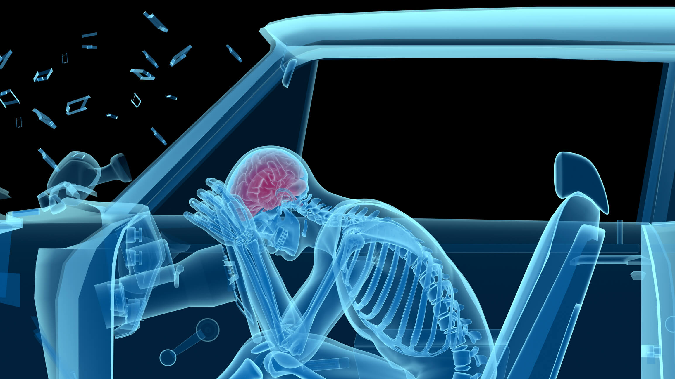 Effects of Traumatic Brain Injuries From Car Accidents - Hale & Monico